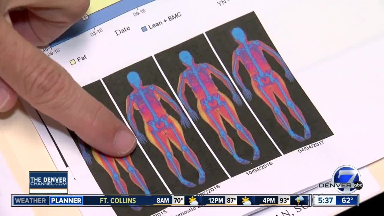 Are smart scales accurate? Low-tech versus high-tech health and ...
