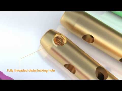 TRIGEN SURESHOT - YouTube