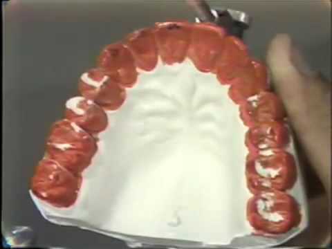 Occlusal Adjustment - Protrusive Movement - YouTube