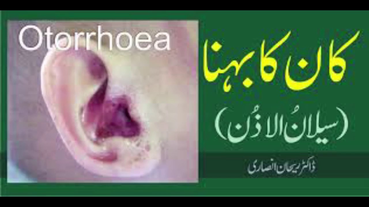 Ear Discharge Otorrhea Cure-1 - YouTube