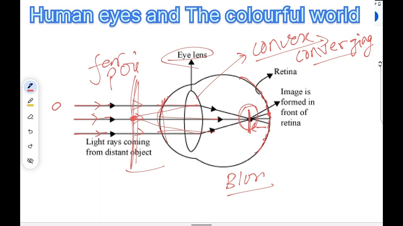 defect of human eye myopia and hypermetropia light optics class 10 ...