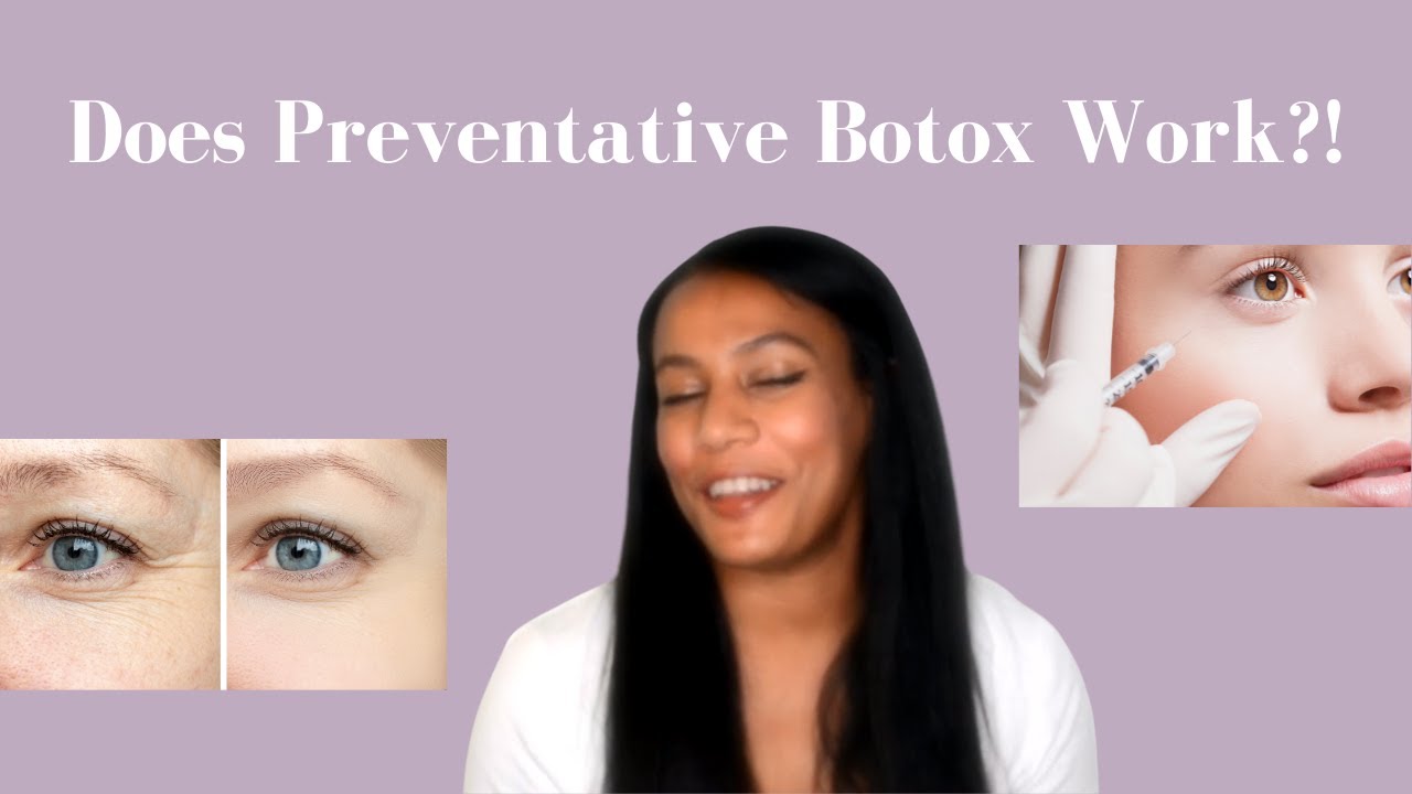 Does Preventative Botox Work? | What Age Should You Start Botox? - YouTube
