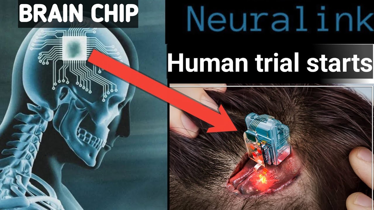 Neural link: brain chip || human trial || elon musk - YouTube