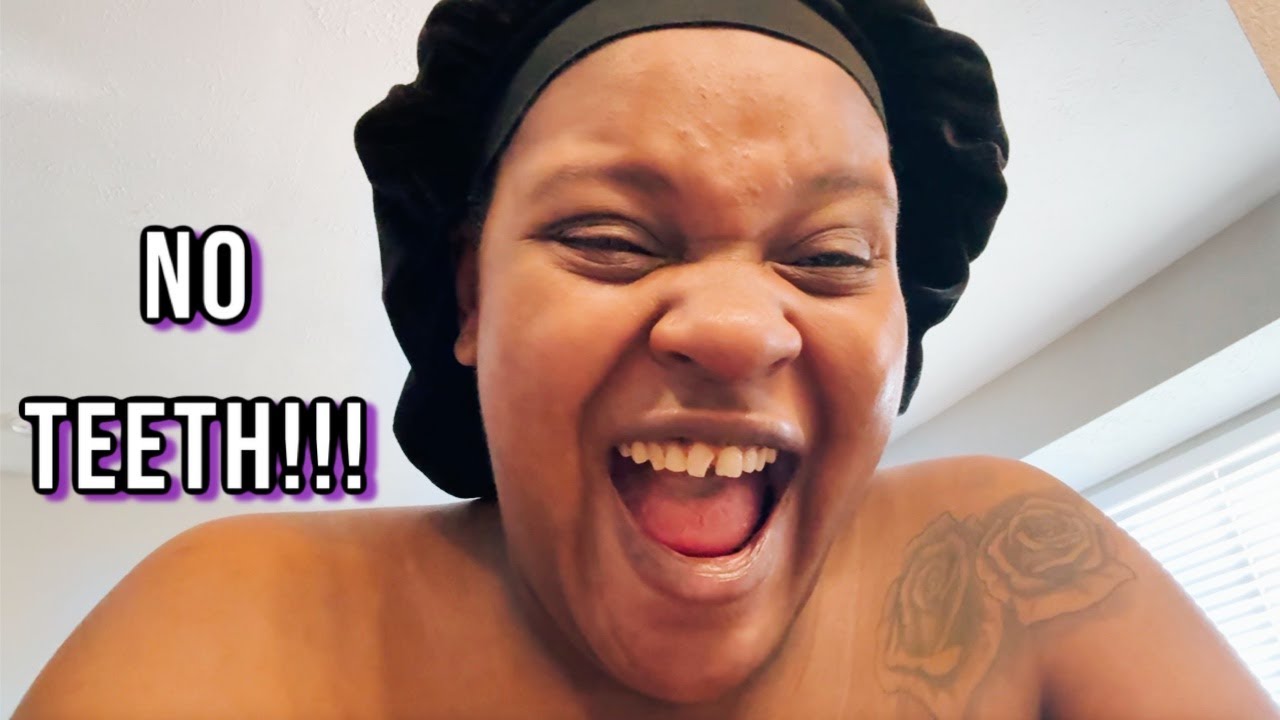 The MOST TRANSPARENT Woman Online... Broken Tooth Reflection 🦷 - YouTube