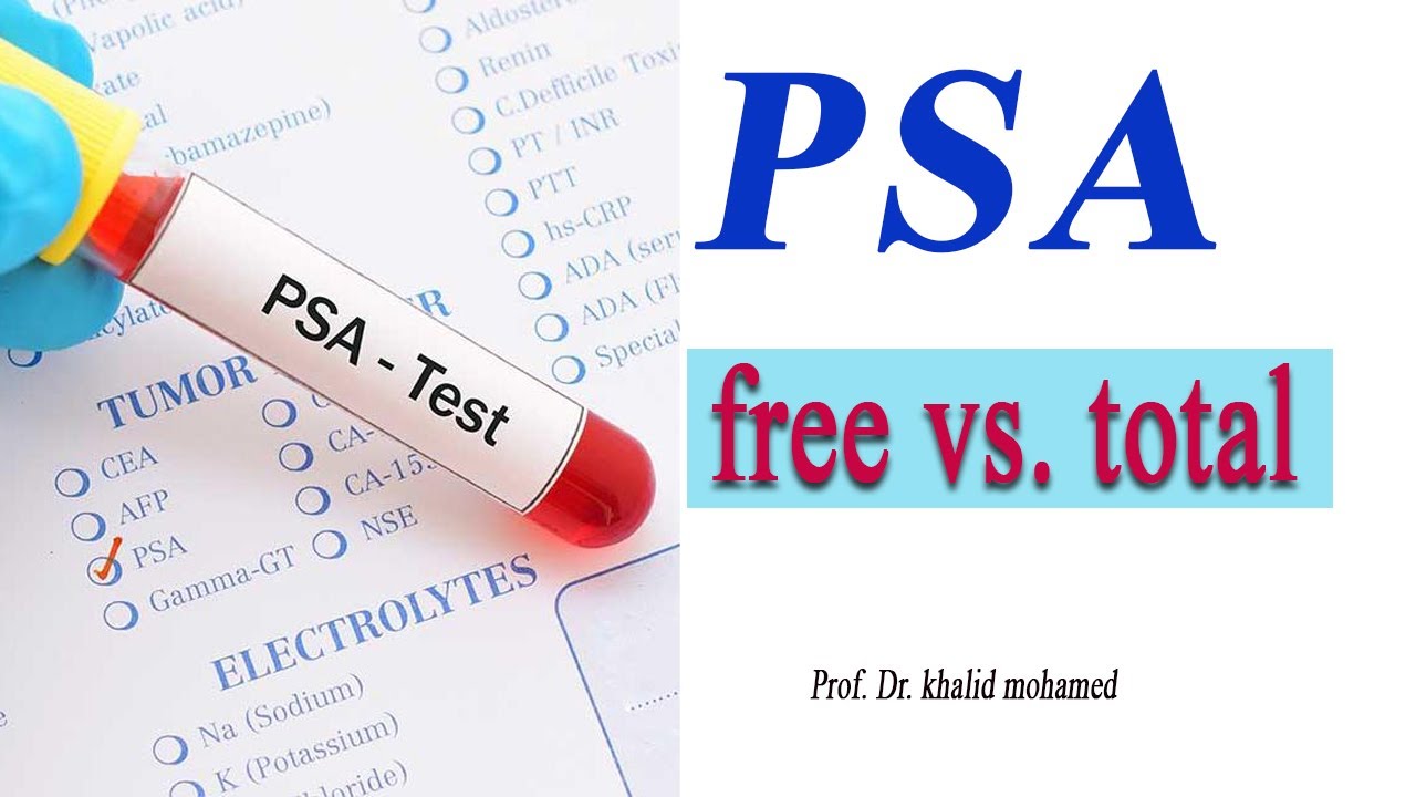 What is PSA test? #PSA #prostateproblems #prostatecancer #urologycare ...