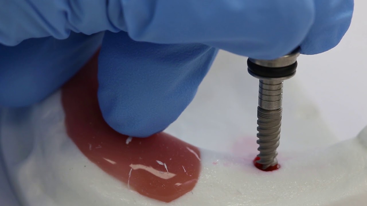 BIOACTIVE IMPLANTS DEMONSTRATION - YouTube