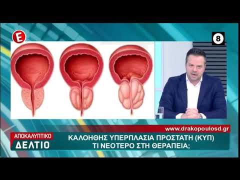 TURIS: Η πιο σύγχρονη θεραπεία για την καλοήθη υπερπλασία προστάτη