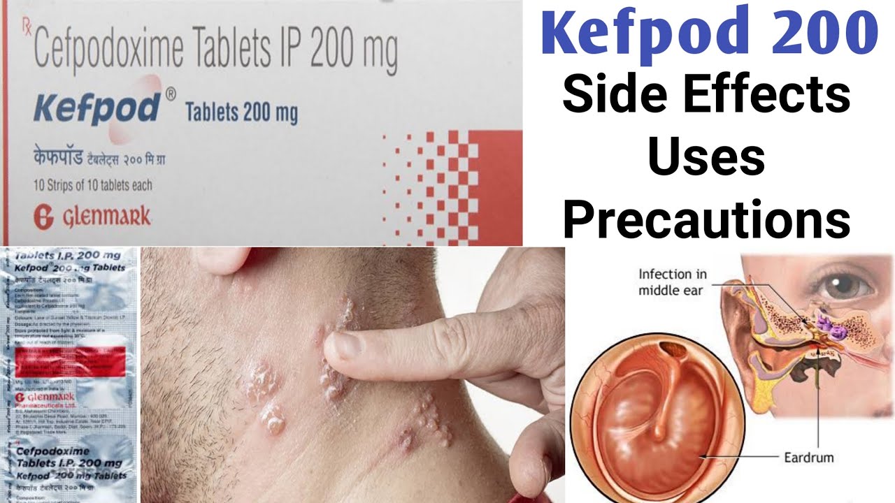 Kefpod 200 tablet uses in hindi । Side Effect | Precaution | Midicine ...