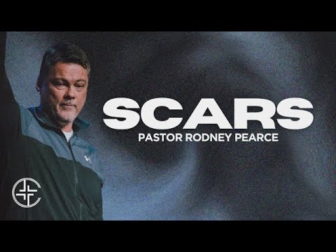 Scars Part 2 | Pastor Rodney | Temple City Church - YouTube