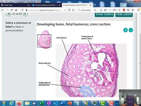Bone tissue - Pearson Practice Anatomy Lab bone and cartilage slides ...