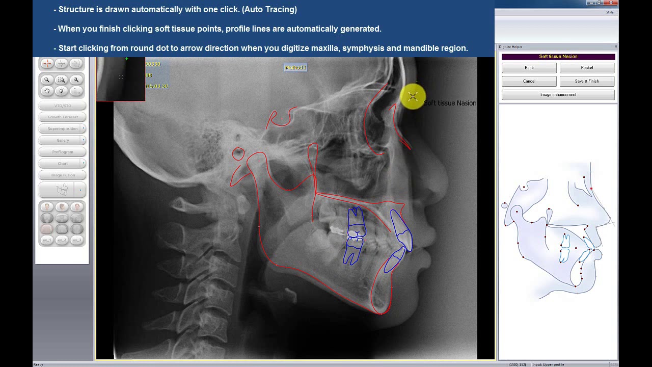 V-Ceph Training Video - YouTube