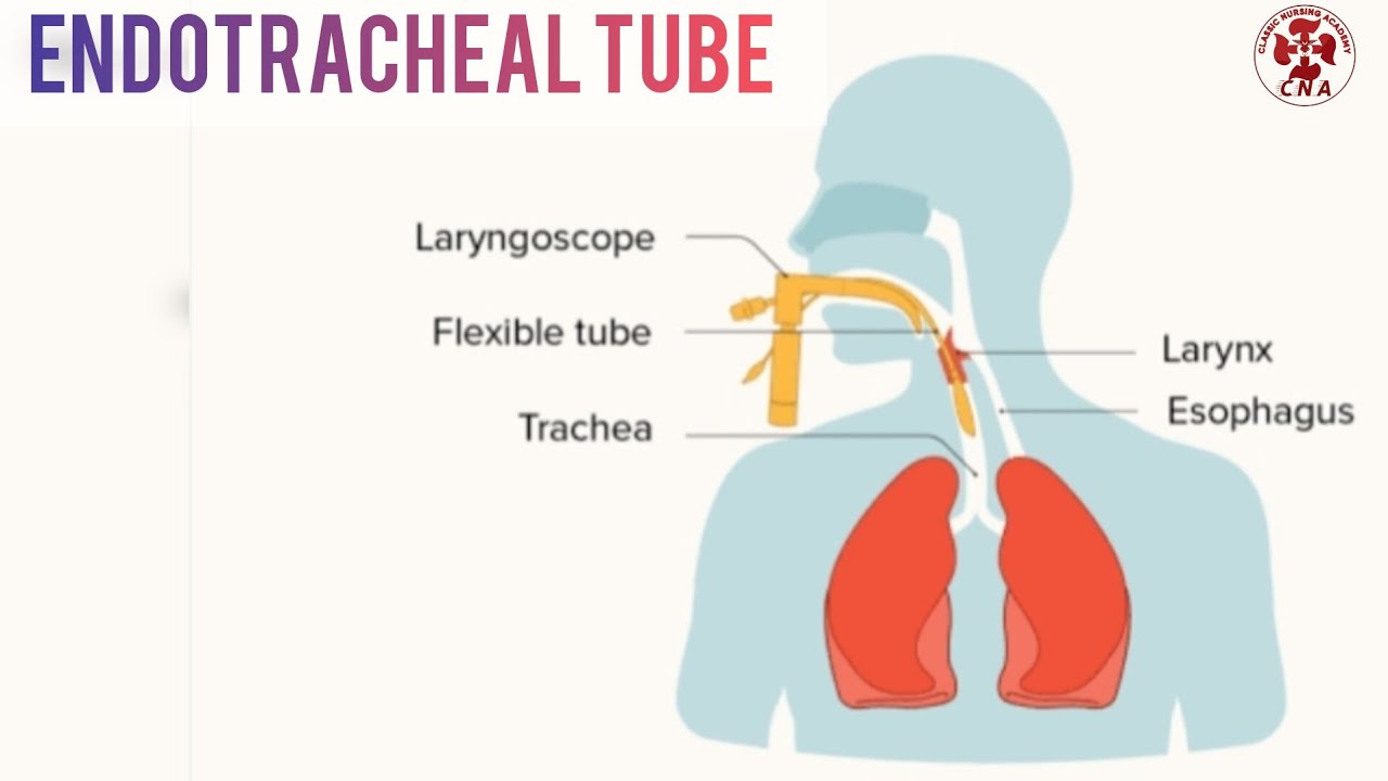 Endotracheal Tube | E.T.Procedure Fundamental Of Nursing | Medical | Easy Explanation | - YouTube