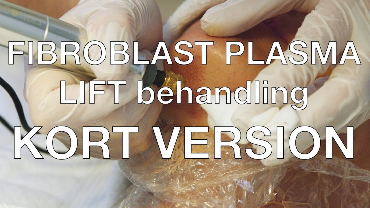 FIBROBLAST PLASMA LIFT behandling (Kort Version) - YouTube