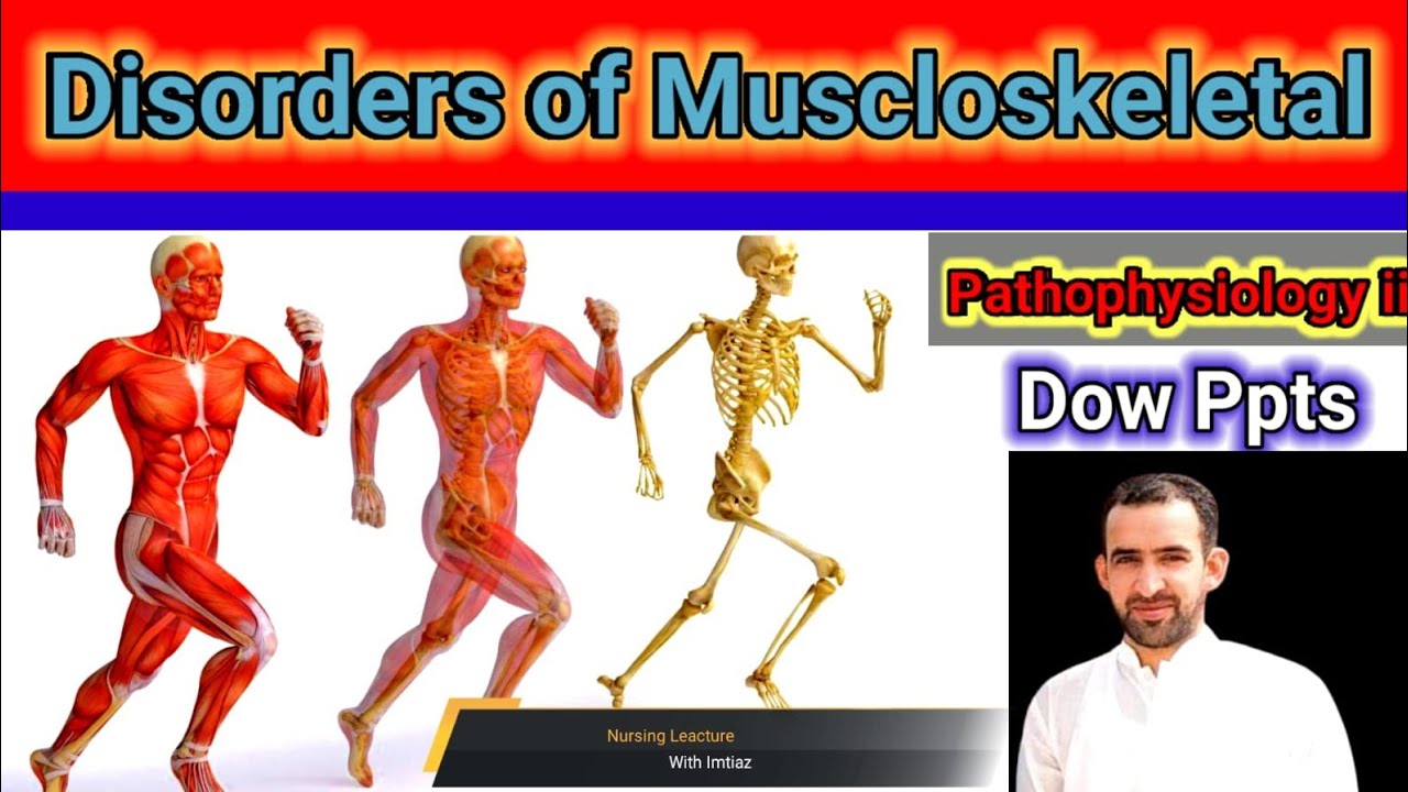Musculoskeletal Disorders/Pathophysiology/ osteoarthritis/Osteoporosis ...