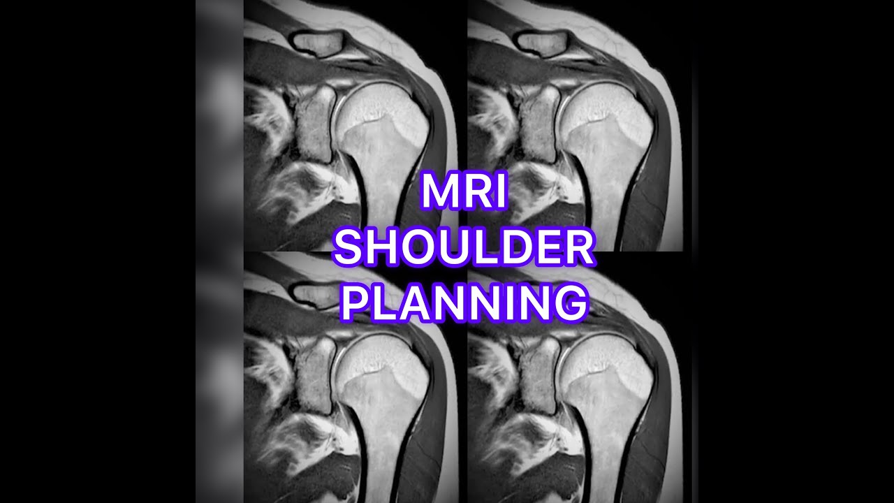 MRI Shoulder Planning - YouTube