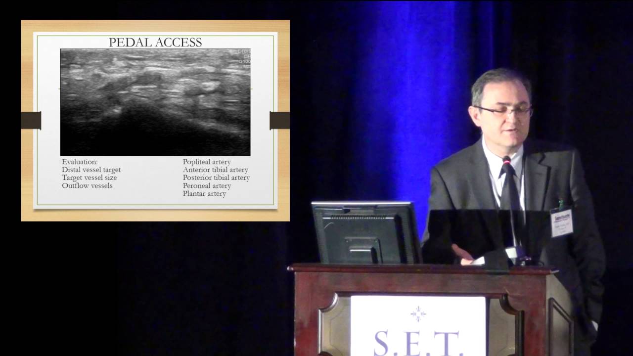 SAFARI Technique - YouTube