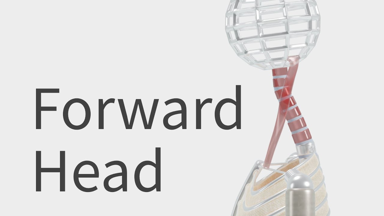 Forward Head Posture,Text Neck, Common Muscle Imbalance. - YouTube