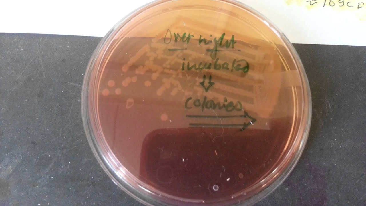 Various methods for preparation of test inocula - YouTube