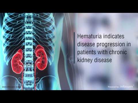 Hematuria indicates disease progression in patients with chronic kidney ...