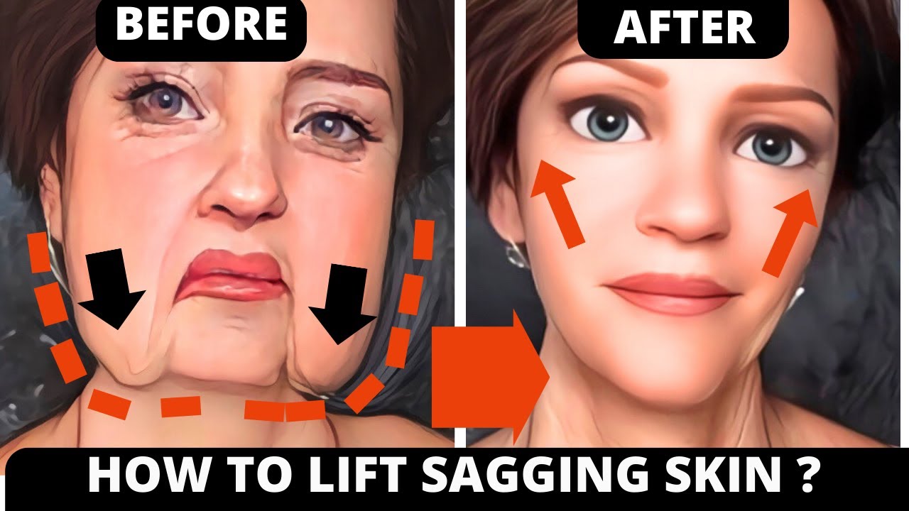 FACE LIFTING EXERCISES FOR SAGGING SKIN, JOWLS, LAUGH LINES, FOREHEAD ...
