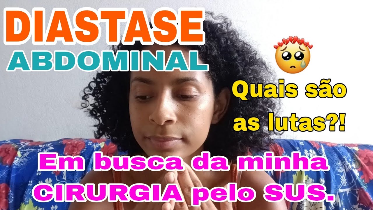DIASTASE ABDOMINAL tem CIRURGIA pelo SUS - YouTube