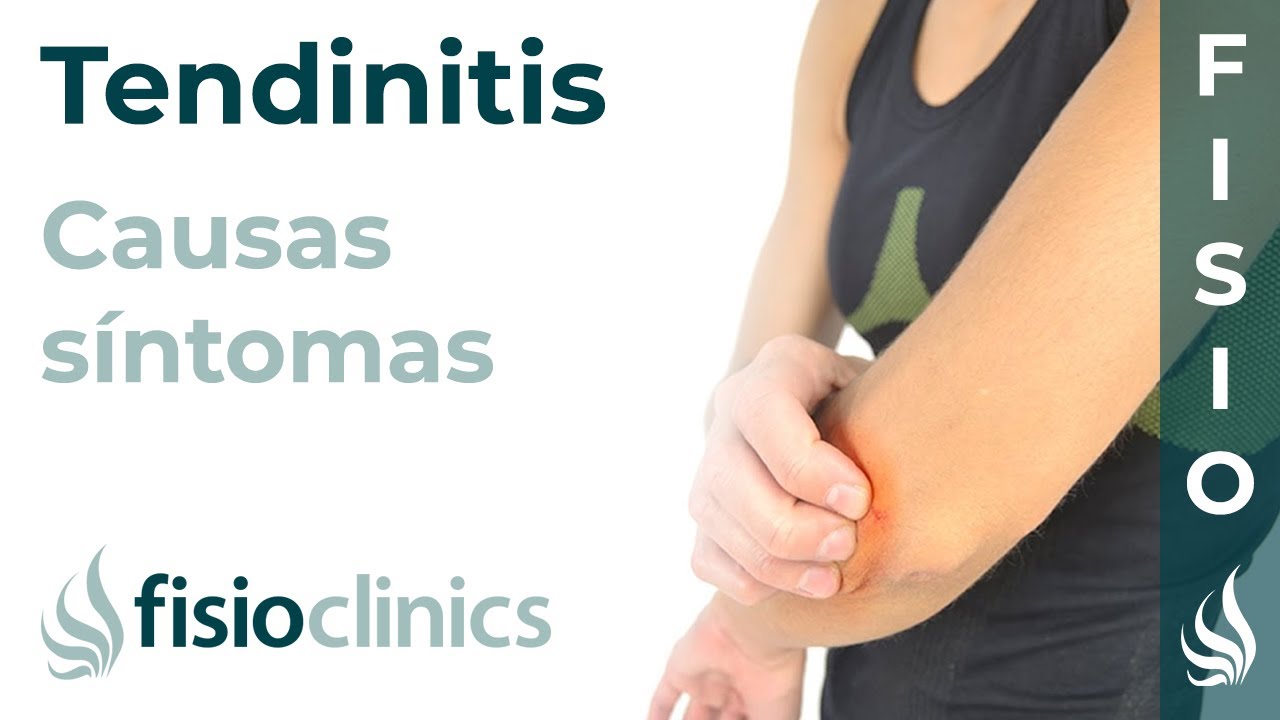 ¿Qué es la tendinitis o inflamación de tendón y cuáles son sus causas ...