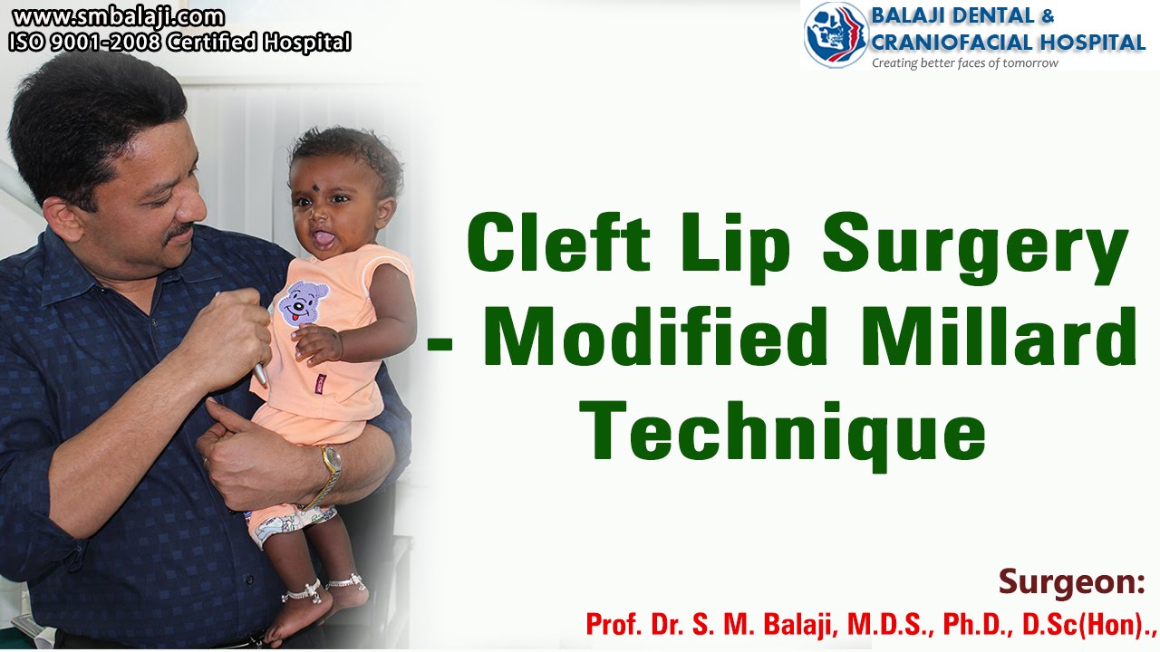 Cleft Lip Surgery Modified Millard - YouTube