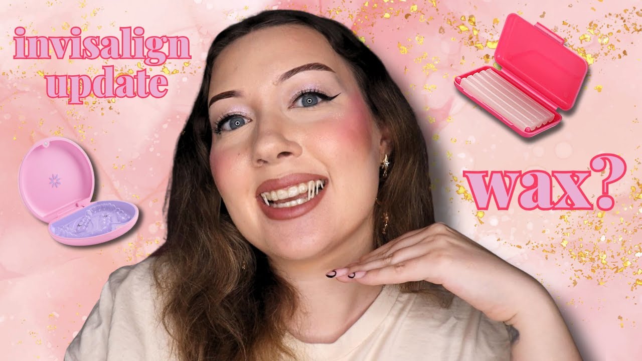 Third Set of Aligners: The Painful Transition To New Elastics! | INVISALIGN UPDATE | GLAM_DIARY ...