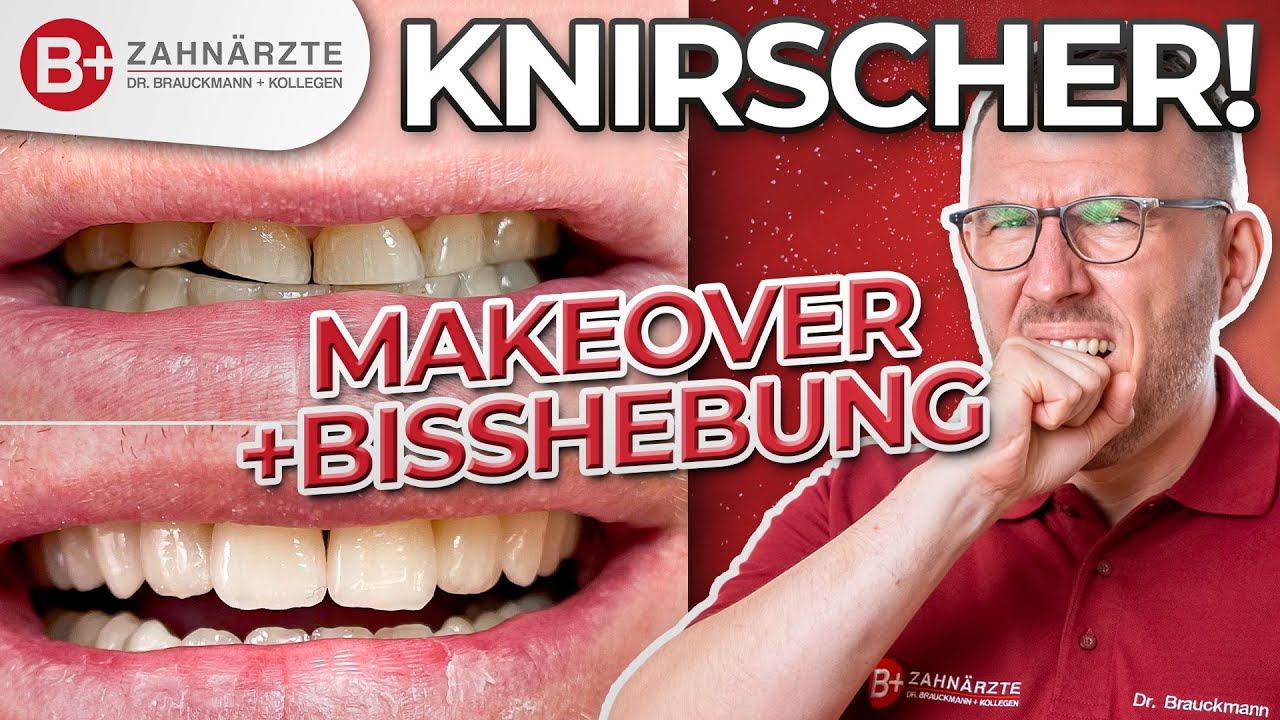 Zähneknirschen - Das kannst Du als Knirscher tun! Patientenfall mit ...