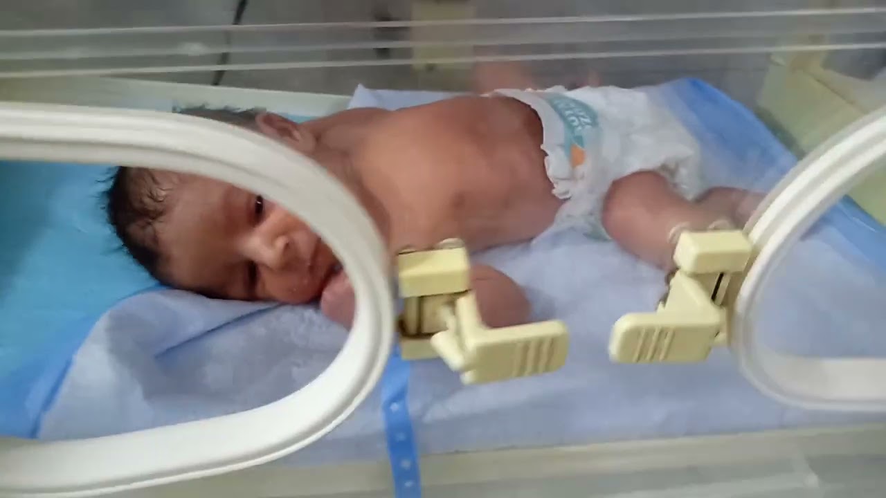 ☺️😯five new born baby recover and discharge same day big surprise ...