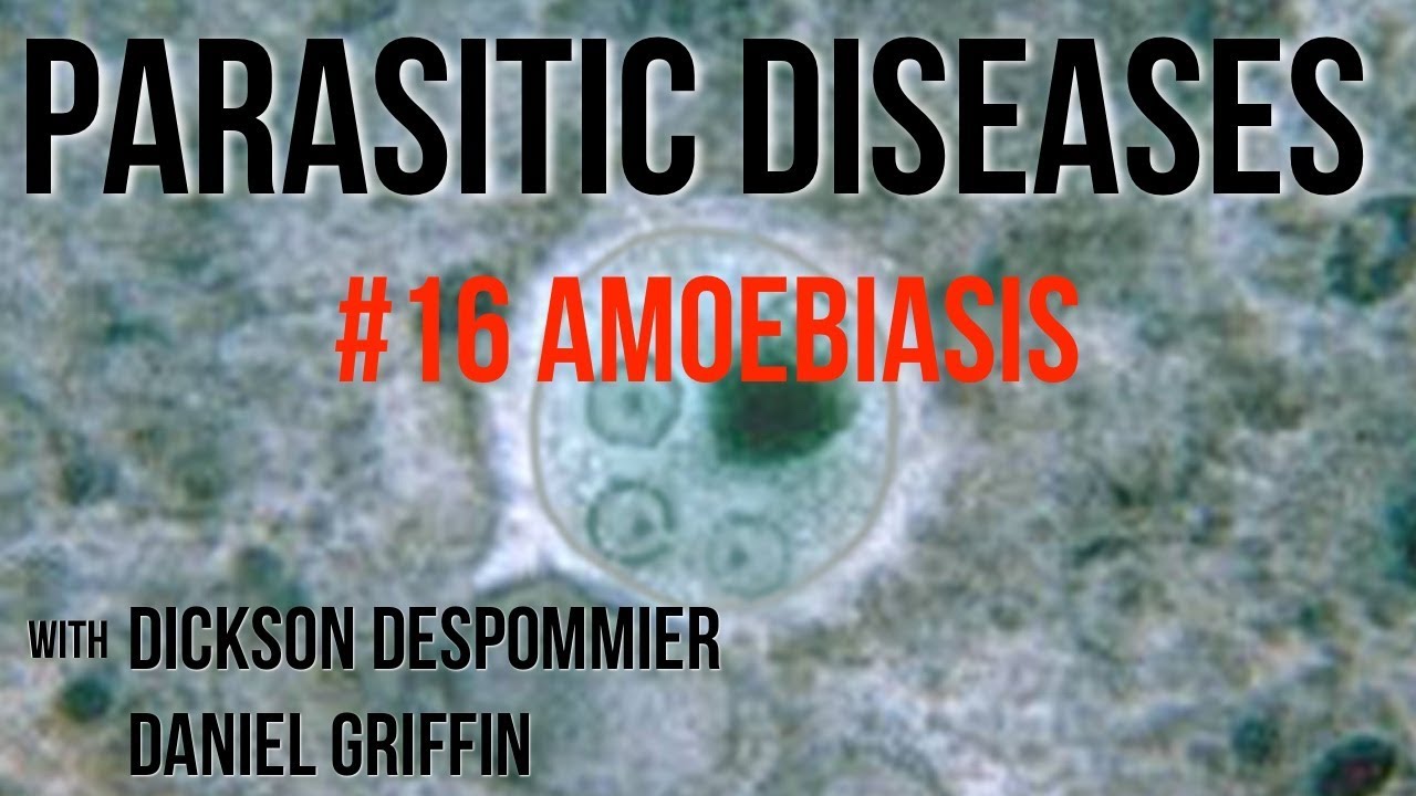 Parasitic Diseases Lectures #16: Amoebiasis - YouTube