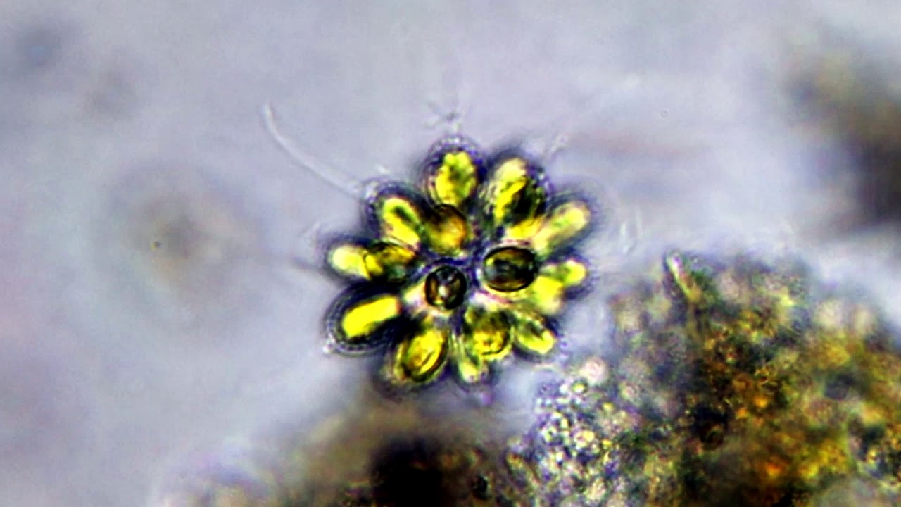 Synura golden algae - YouTube