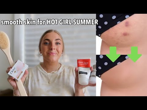 How I Got Rid Of Bum Acne (Folliculitis): beach bikini body skin care routine for *hot girl summer*