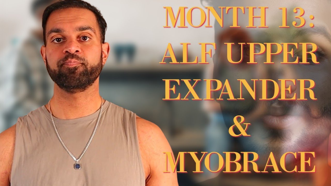 Month 13 TREATMENT COMPLETED: ALF Upper Expander Myobrace [My ...