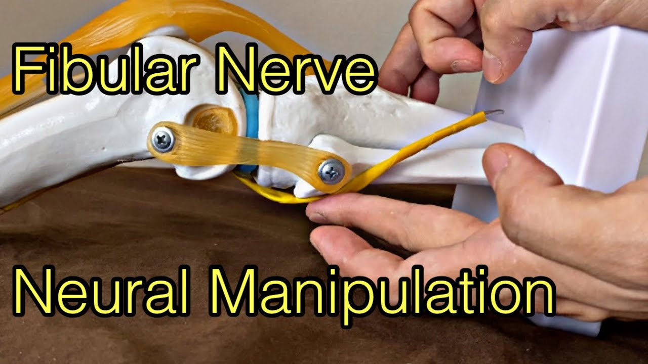 How to do neural manipulation for fibular nerve (English) - YouTube