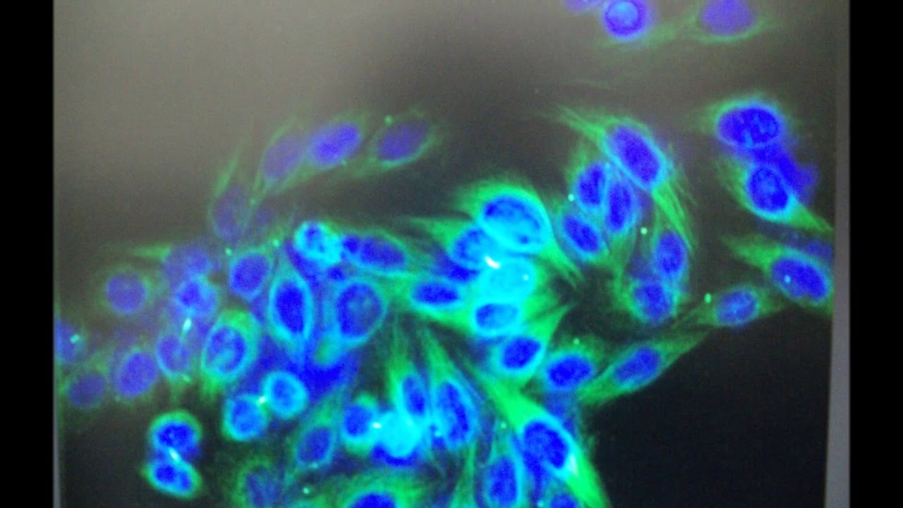 Proyecto Microscopia de fluorescencia - YouTube