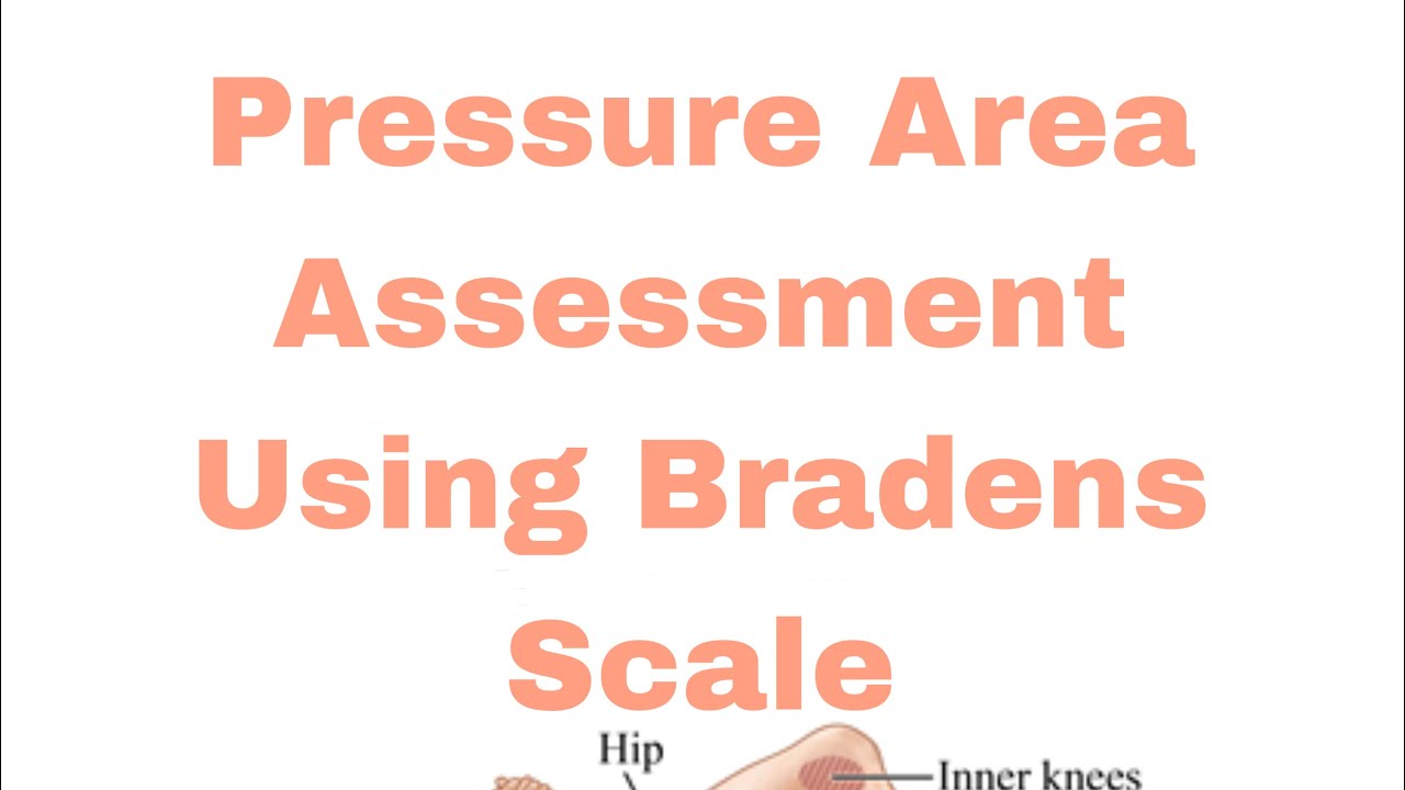 Pressure Area Assessment using Braden Scale Tool - YouTube