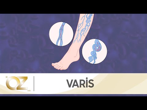Varis