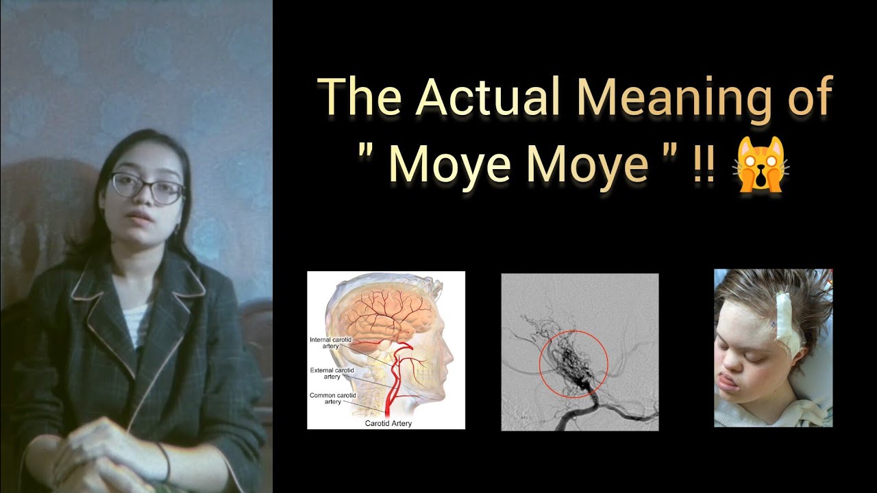 The Actual Meaning Of "Moye Moye "😯.. Reality of the Moye Moye Trend ...