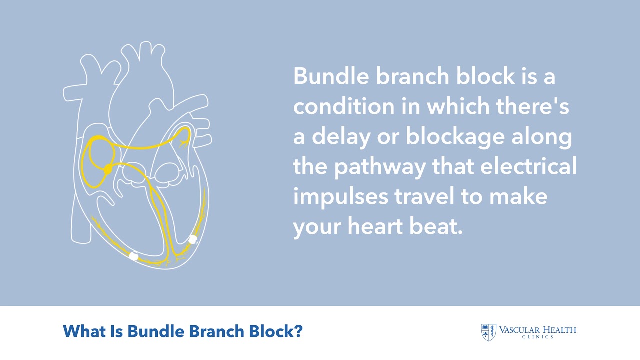 Bundle Branch Block - YouTube