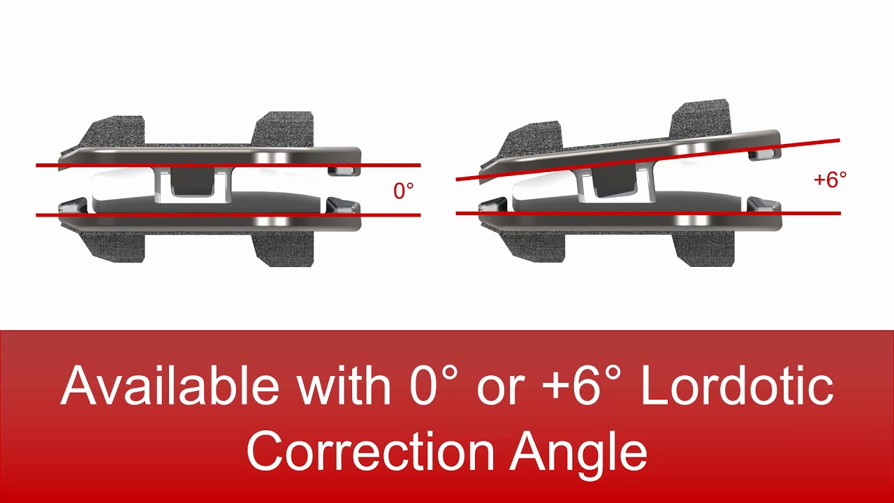 Synergy Disc Overview Video 2019 - YouTube