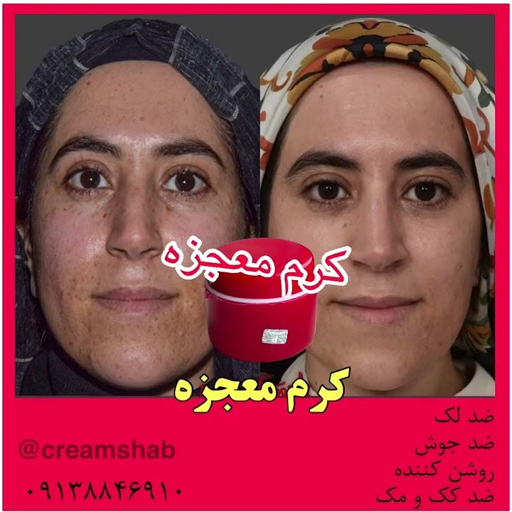 کرم معجزه شباین کرم ۱۰۰٪ گیاهی و دست ساز می باشدواقعا معجزه کافیه یک بار امتحان کنید Youtube
