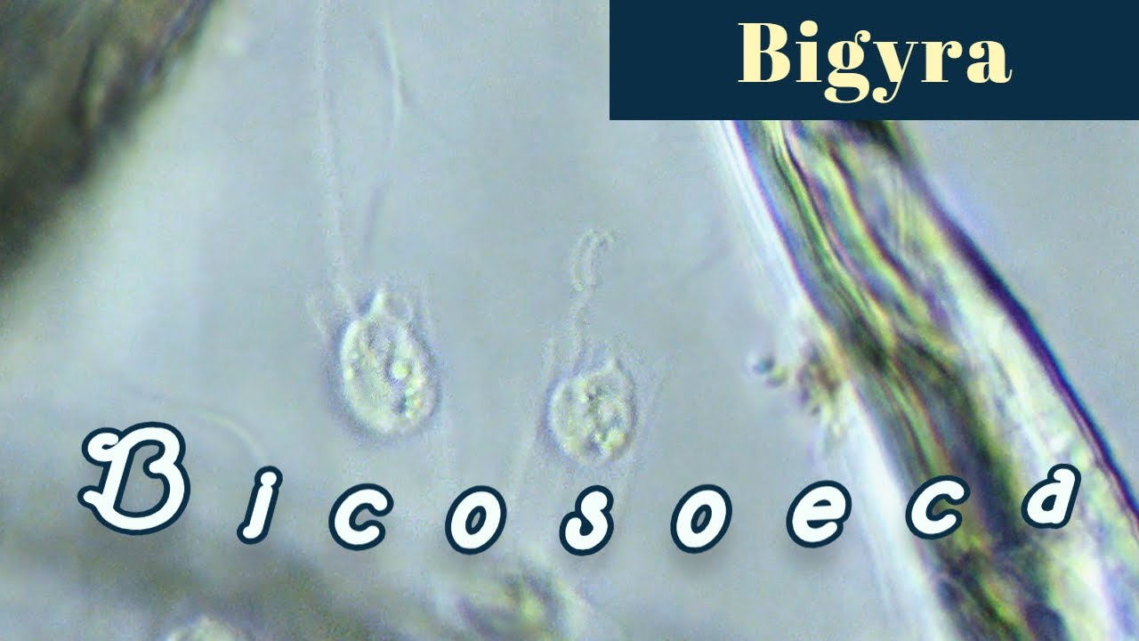 Bicosoeca (Bigyra, Heterotrophic flagellates) №3 - YouTube