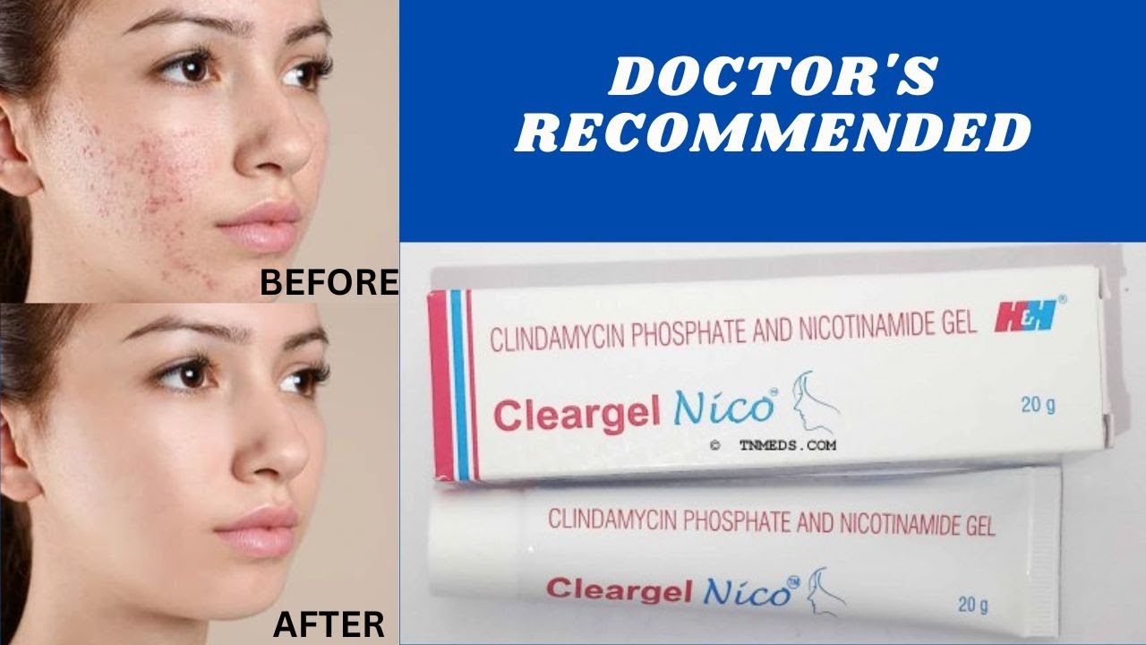 Clear Gel Review | Remove Acne, Pimples, Scars, Pigmentation, Dark Spot ...