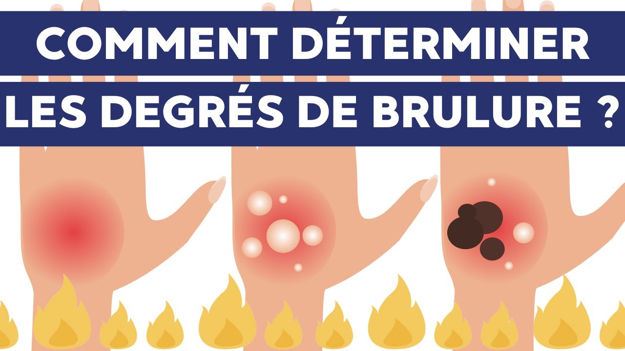 Comment déterminer les degrés de brulure ? - YouTube