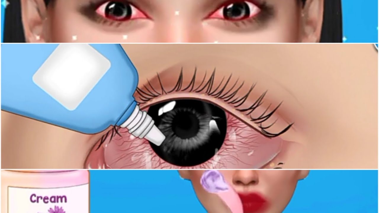 ASMR Satisfying Eyelid Sebum Extrusion Animation/Eye Treatment - YouTube