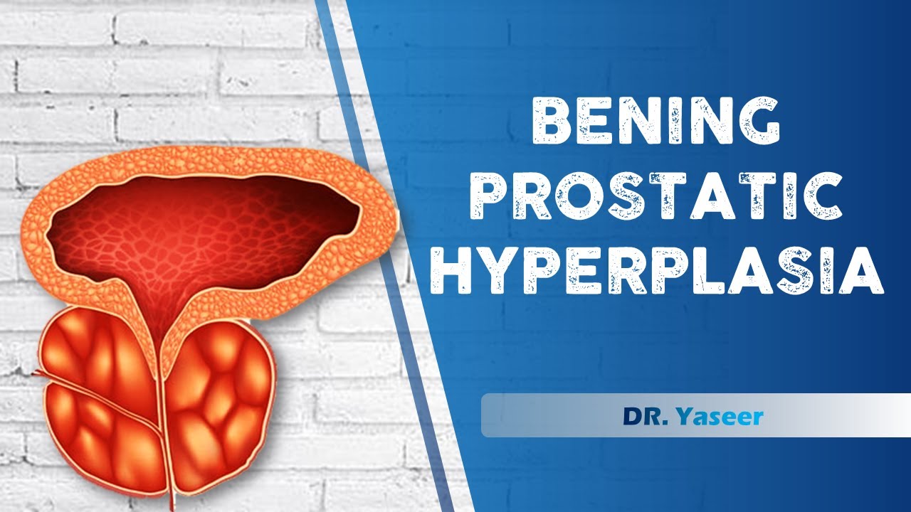 Benign Prostatic Hyperplasia || Dr. Yaser || Lecture 5 - YouTube