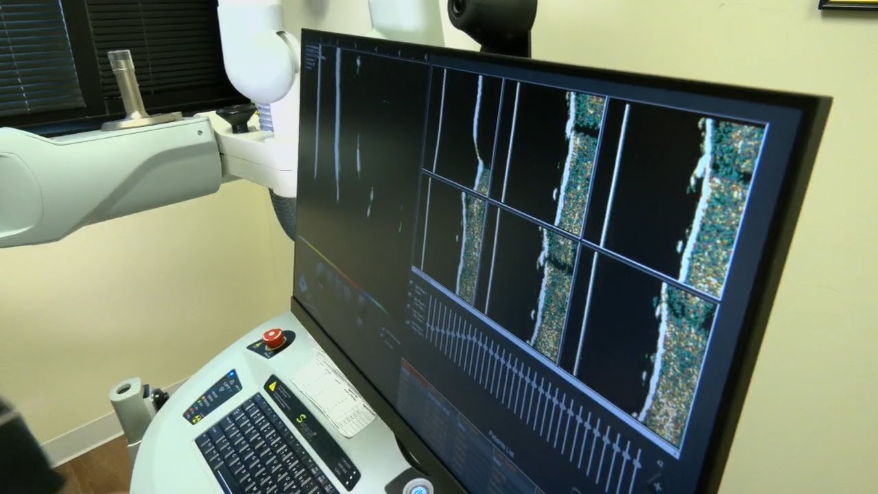Kentucky clinic using innovative new approach to curing skin cancer ...