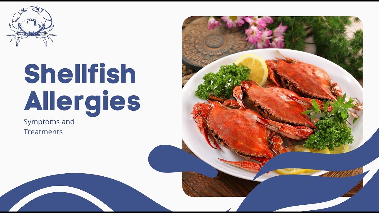 Shellfish Allergies: Symptoms and Treatments - YouTube