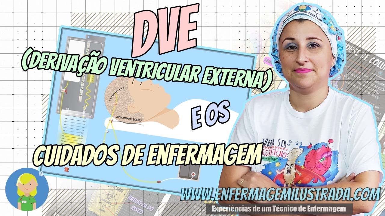 A DVE (Derivação Ventricular Externa) e os cuidados INTENSIVOS de ...